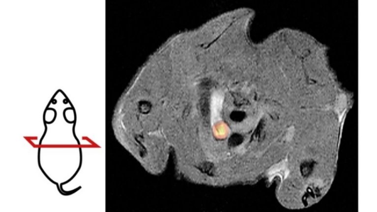 Watching atherosclerosis as it develops | BioRegio STERN | Wirtschaft ...